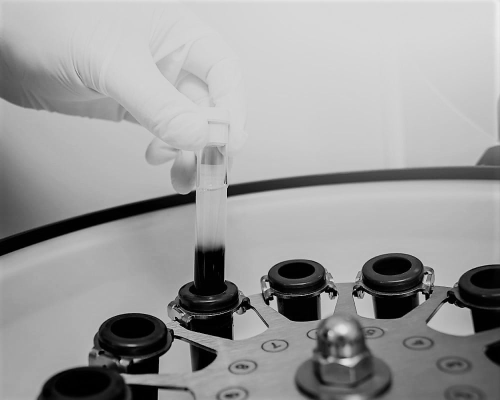 Platelet Rich Fibrin (PRF) - ADDC Total Cosmetic Care